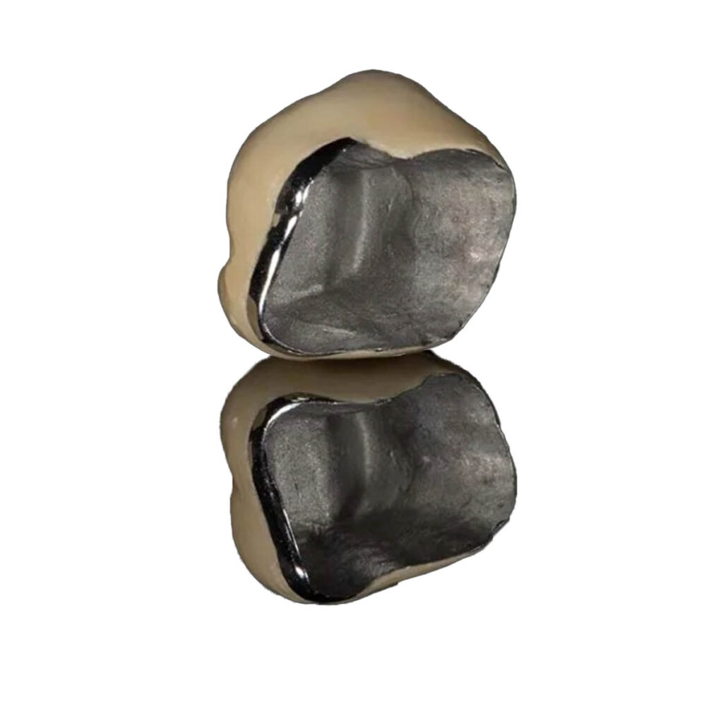 Corona Metal Cerámica - DentalWorks